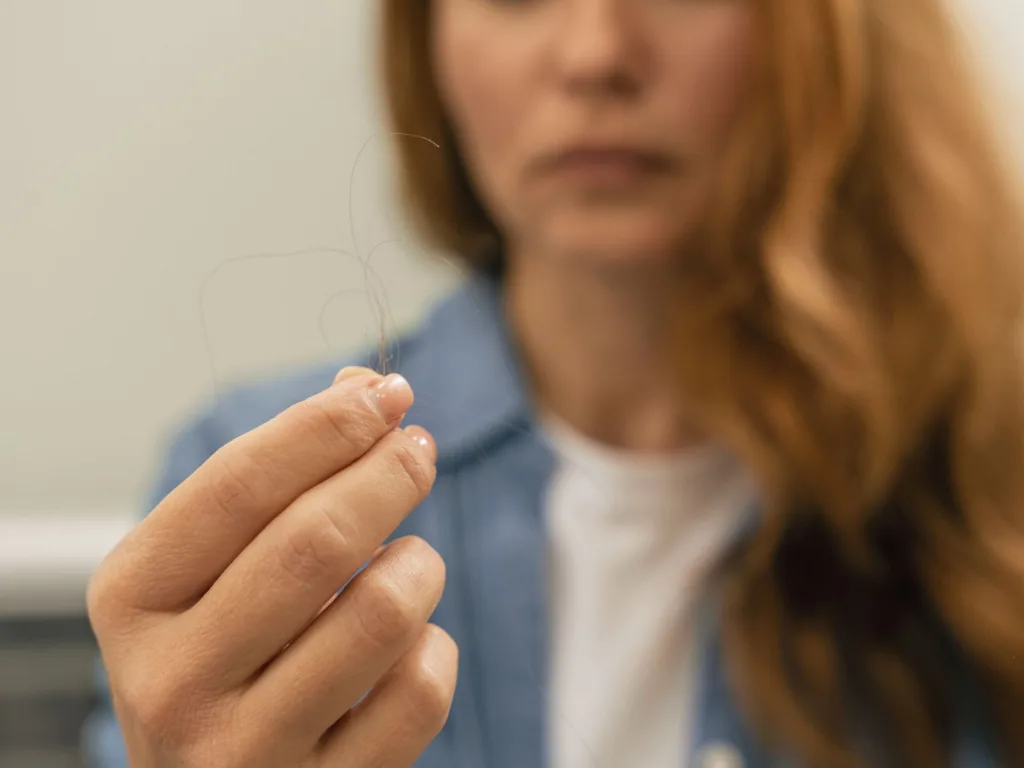 Explorando la Pérdida de Cabello en el Hipertiroidismo - Hair Medical ...